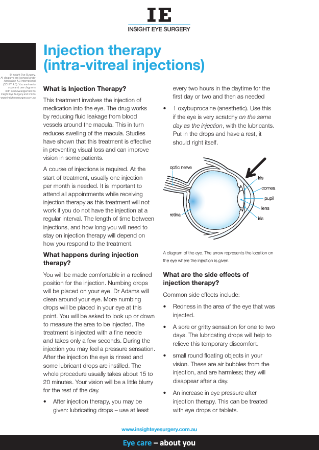 Eye Injection Clinic - Insight Eye Surgery